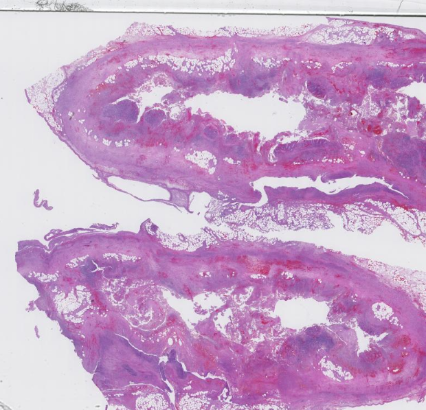 Digital Pathology Solutions | Whole Slide Imaging Services | Albany ...